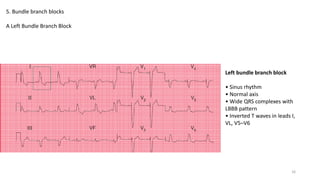 ECG-cases.pptx