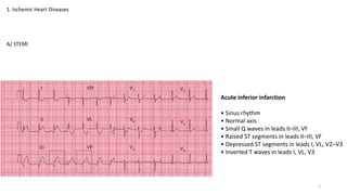 ECG-cases.pptx