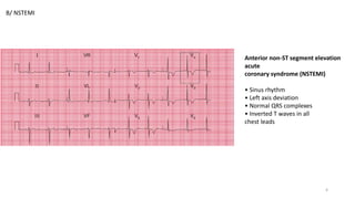 ECG-cases.pptx