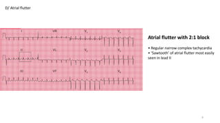 ECG-cases.pptx