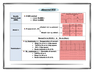 ECG-Dr.Allam منقول.pdf