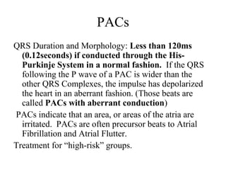 Ecg dysrhythmias-ii | PPT