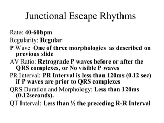 Ecg dysrhythmias-ii | PPT