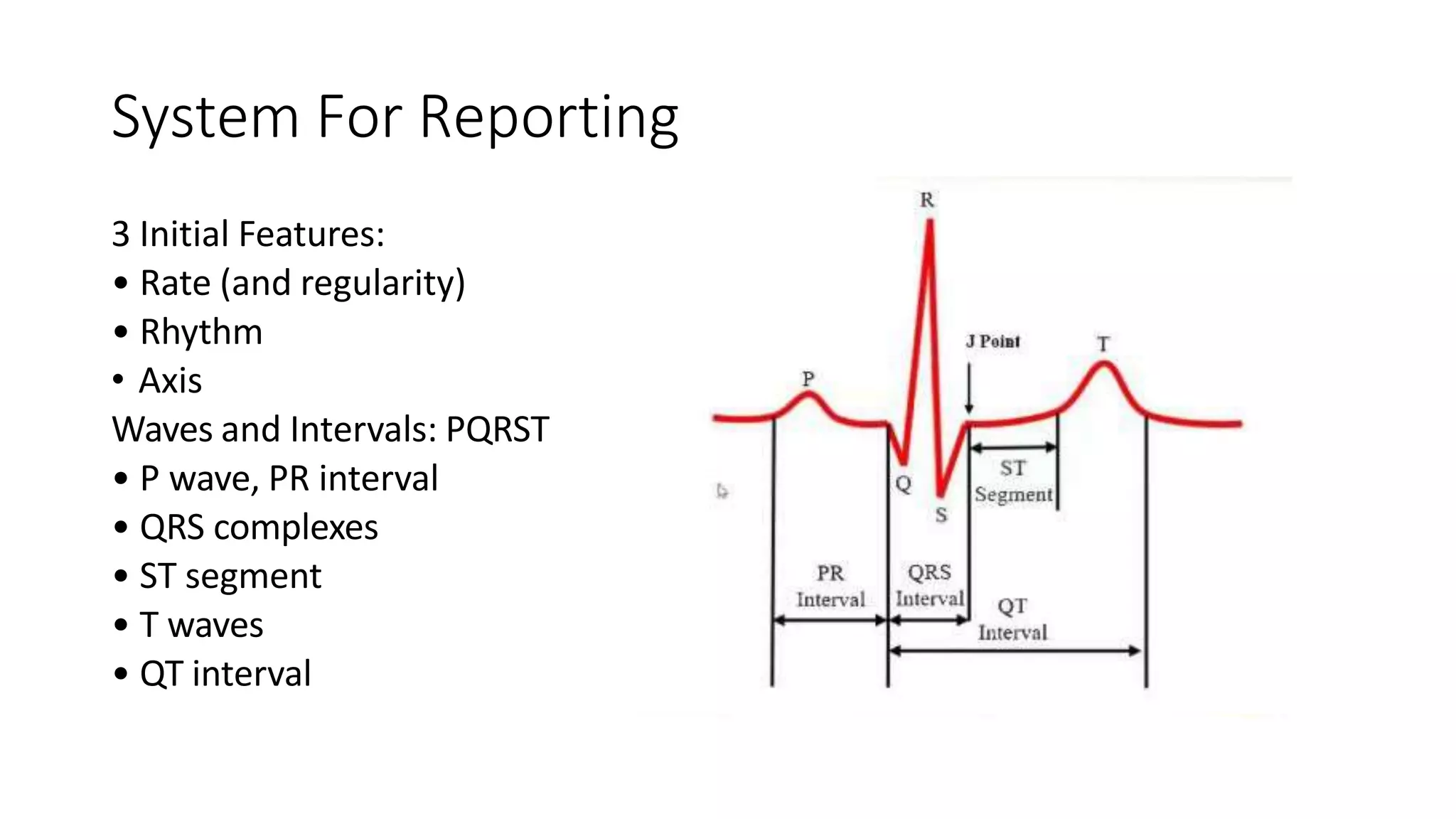 ECG | PPT