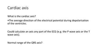 ECG | PPTX