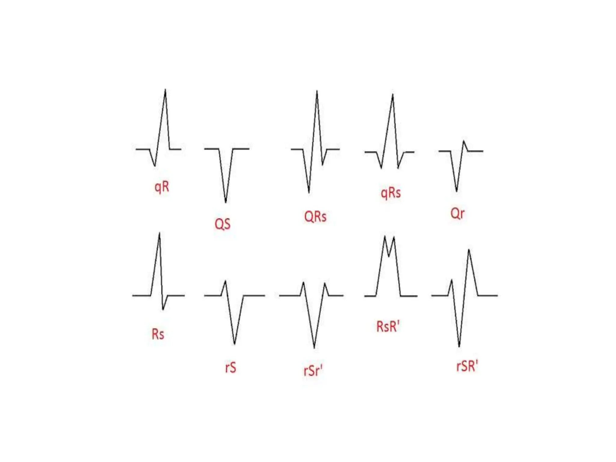 ECG- ELECTROCARDIOGRAM basics and interpretation | PPT