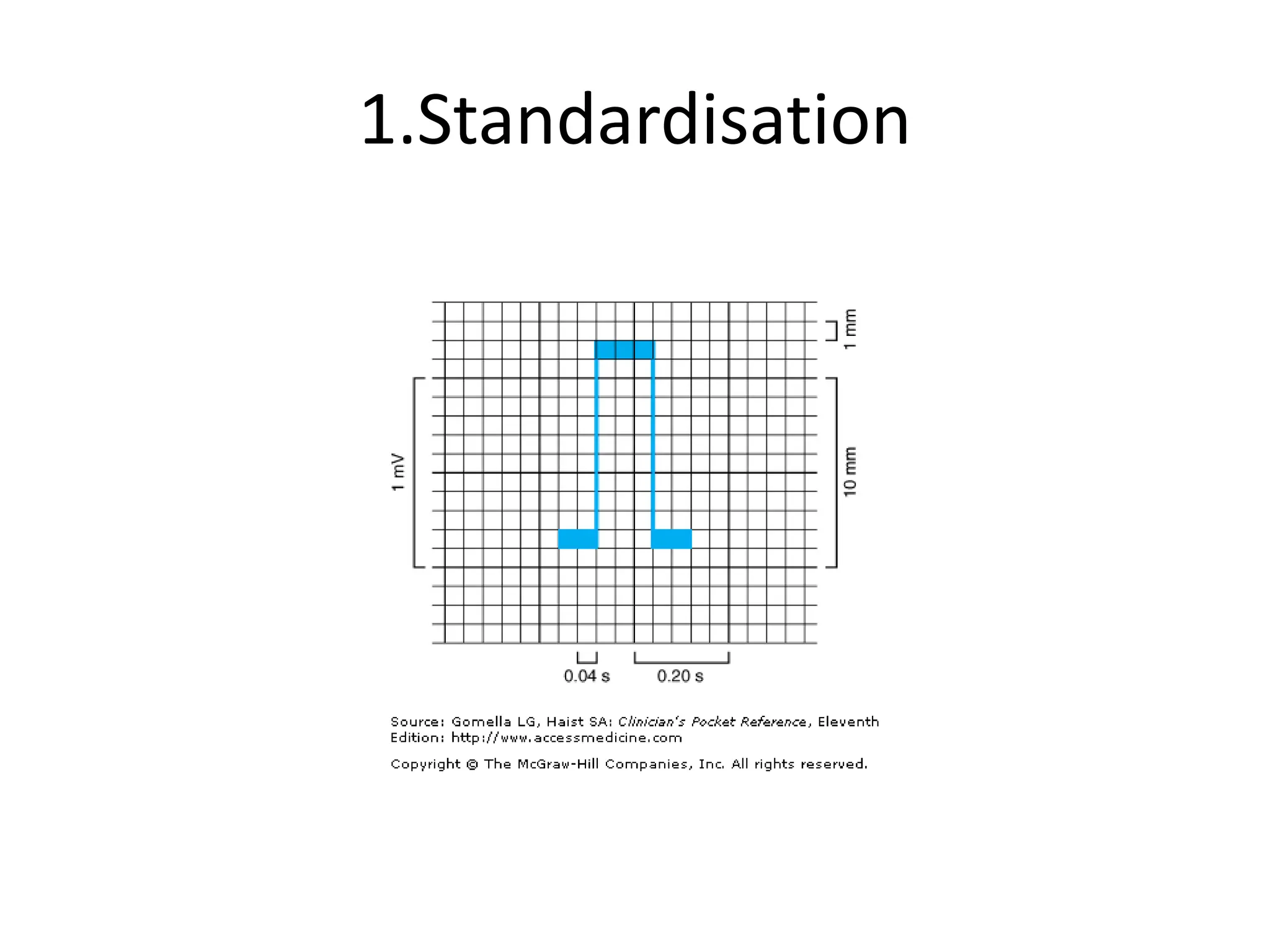 ECG- ELECTROCARDIOGRAM basics and interpretation | PPT