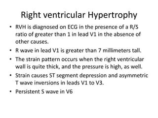 ECG- ELECTROCARDIOGRAM basics and interpretation | PPT