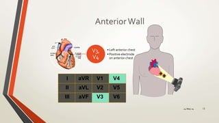 ECG | PPTX