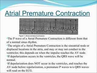 Ecg How read. dr mahipal india | PPT