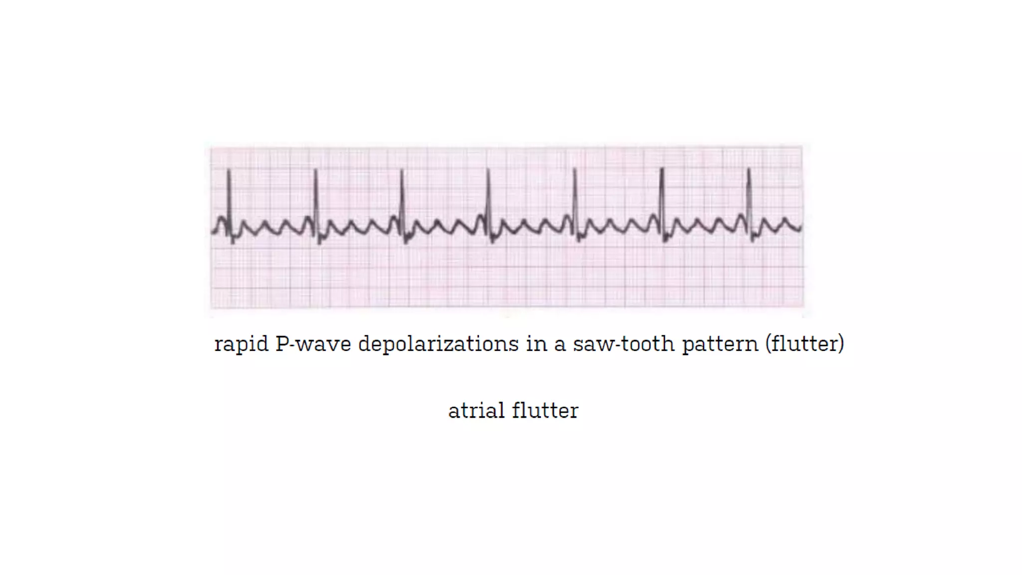 ECG-Interpretation-1.pptx
