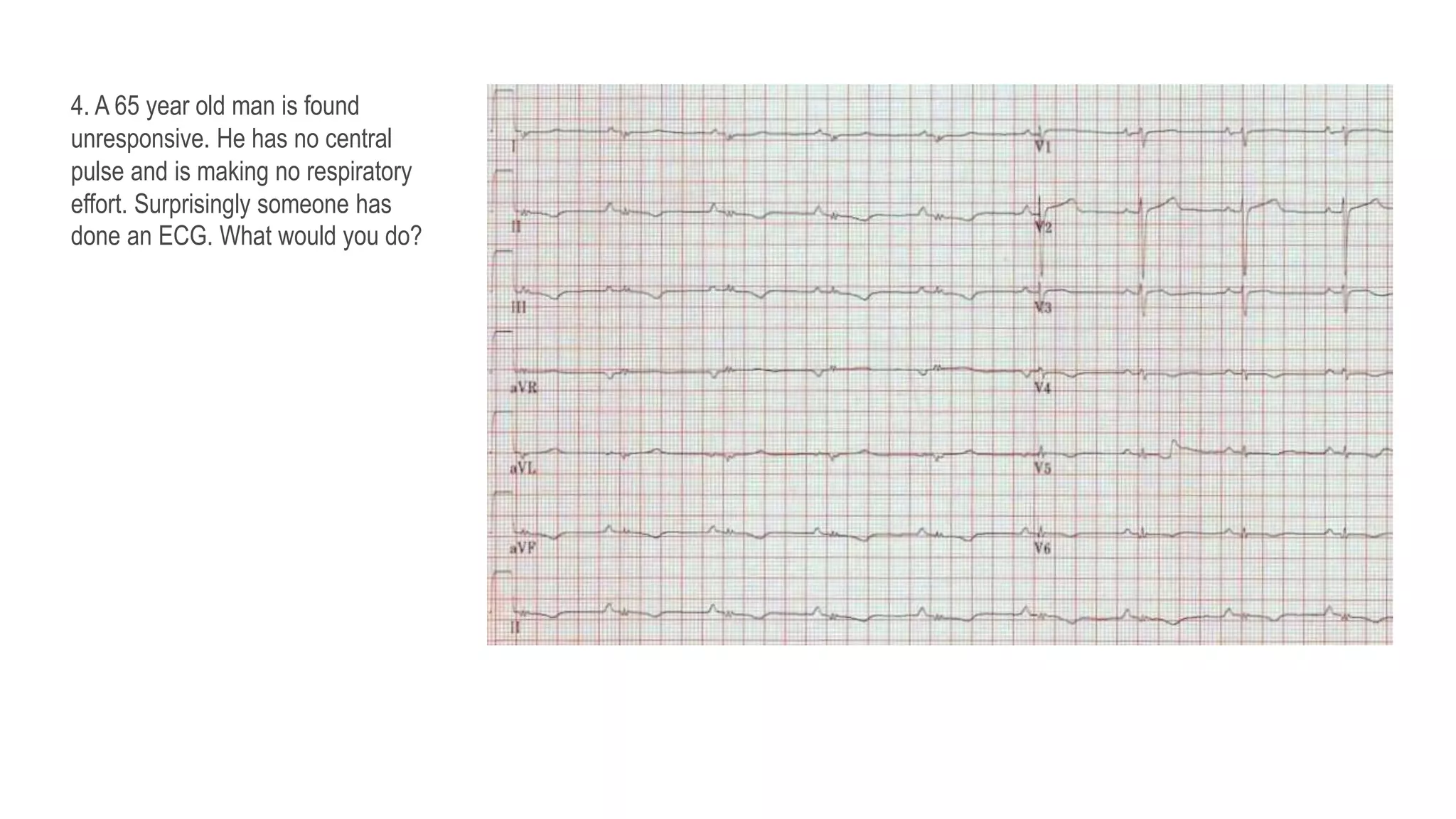 ECG-Interpretation-1.pptx