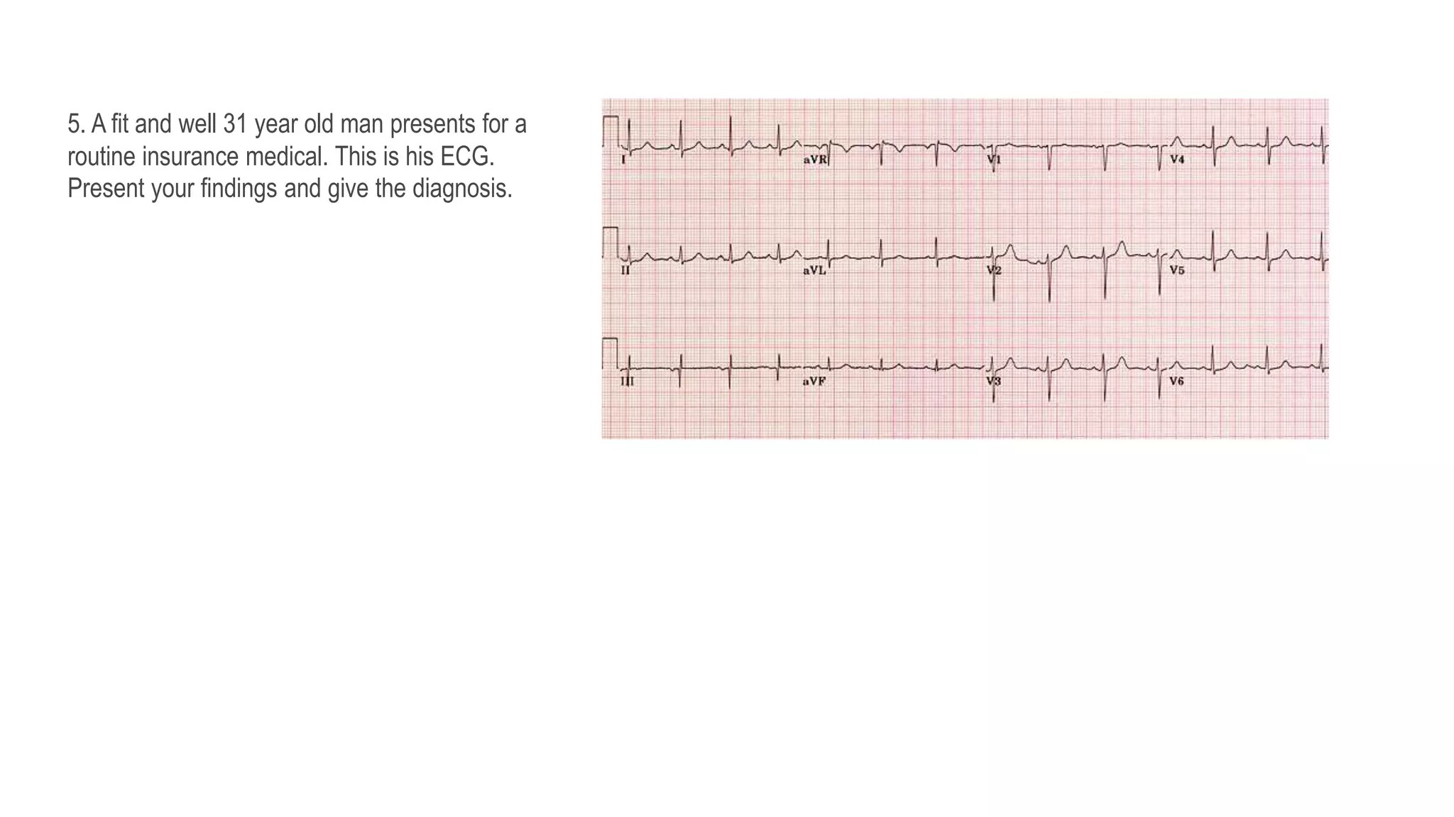 ECG-Interpretation-1.pptx