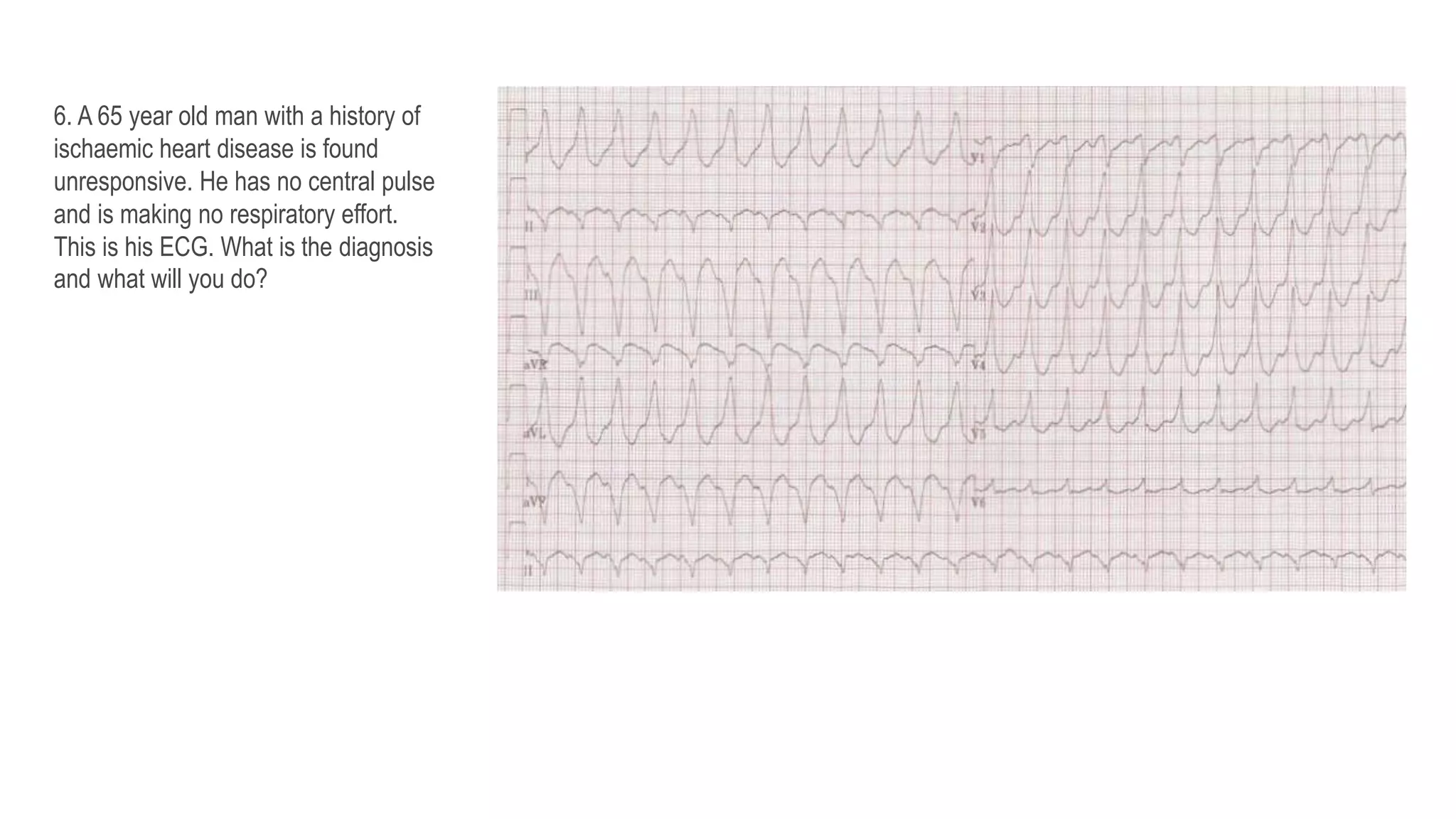 ECG-Interpretation-1.pptx