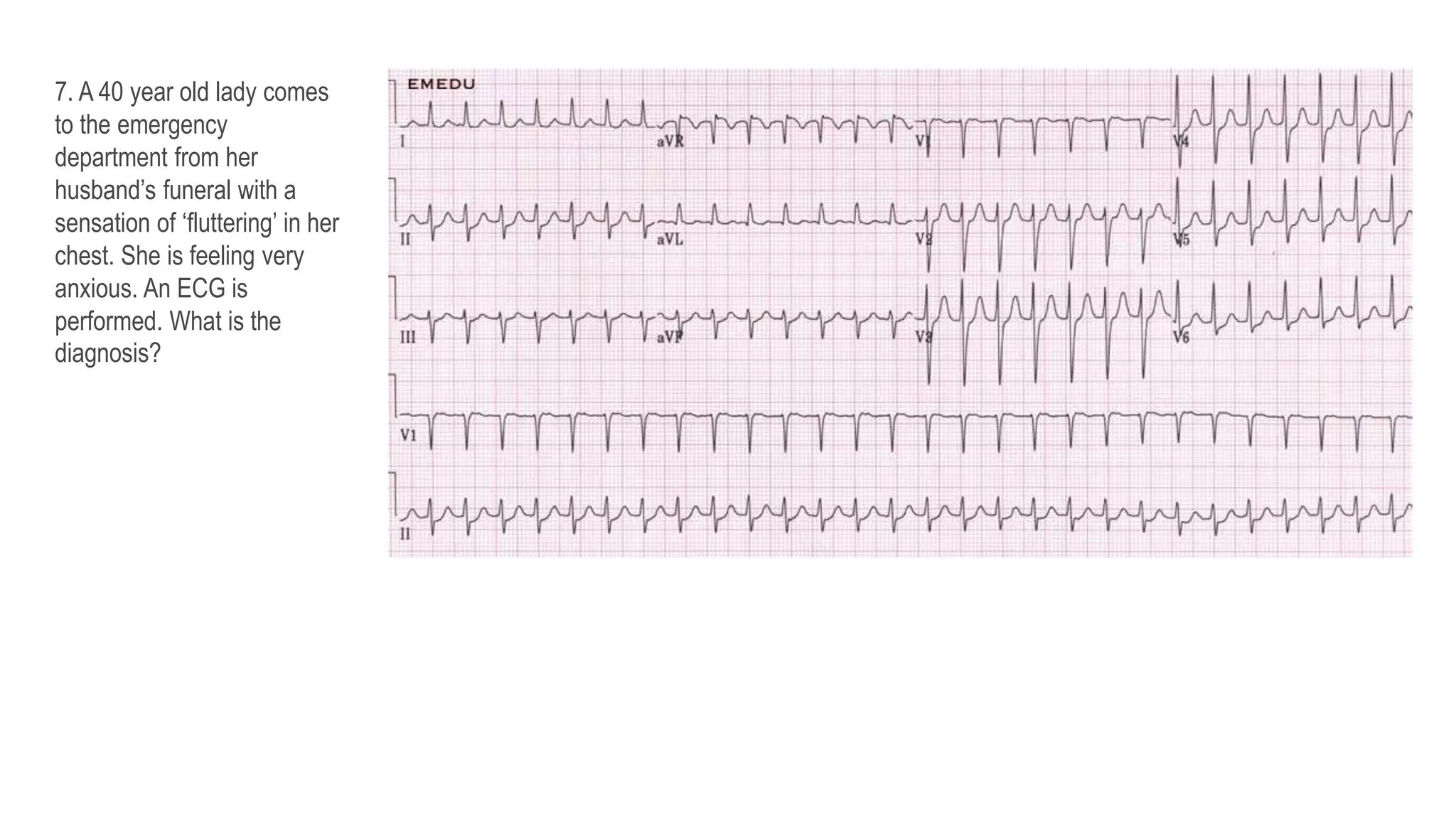 ECG-Interpretation-1.pptx