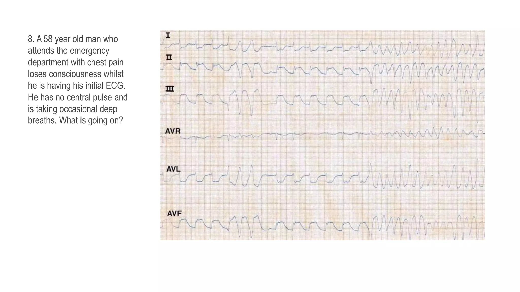 ECG-Interpretation-1.pptx
