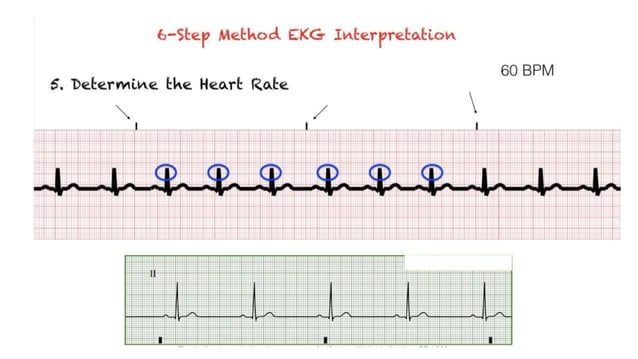 ECG-Interpretation-1.pptx