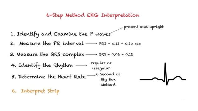ECG-Interpretation-1.pptx