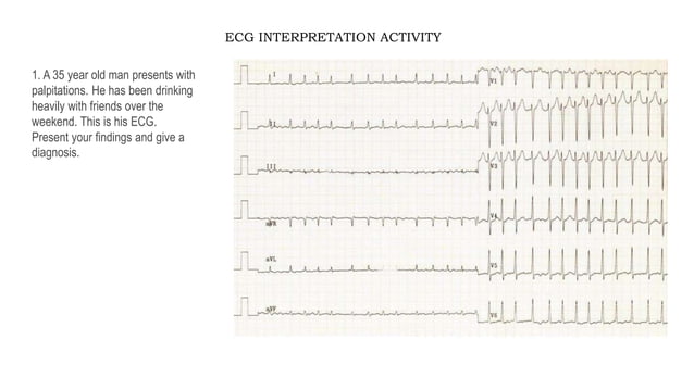 ECG-Interpretation-1.pptx
