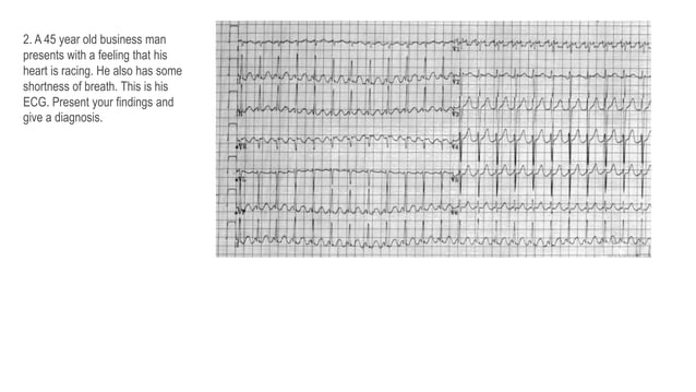 ECG-Interpretation-1.pptx
