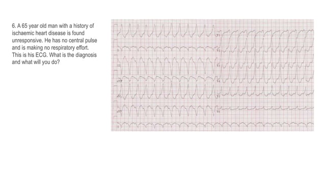 ECG-Interpretation-1.pptx
