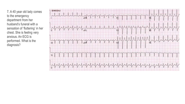 ECG-Interpretation-1.pptx
