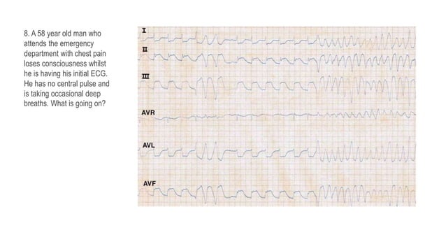 ECG-Interpretation-1.pptx