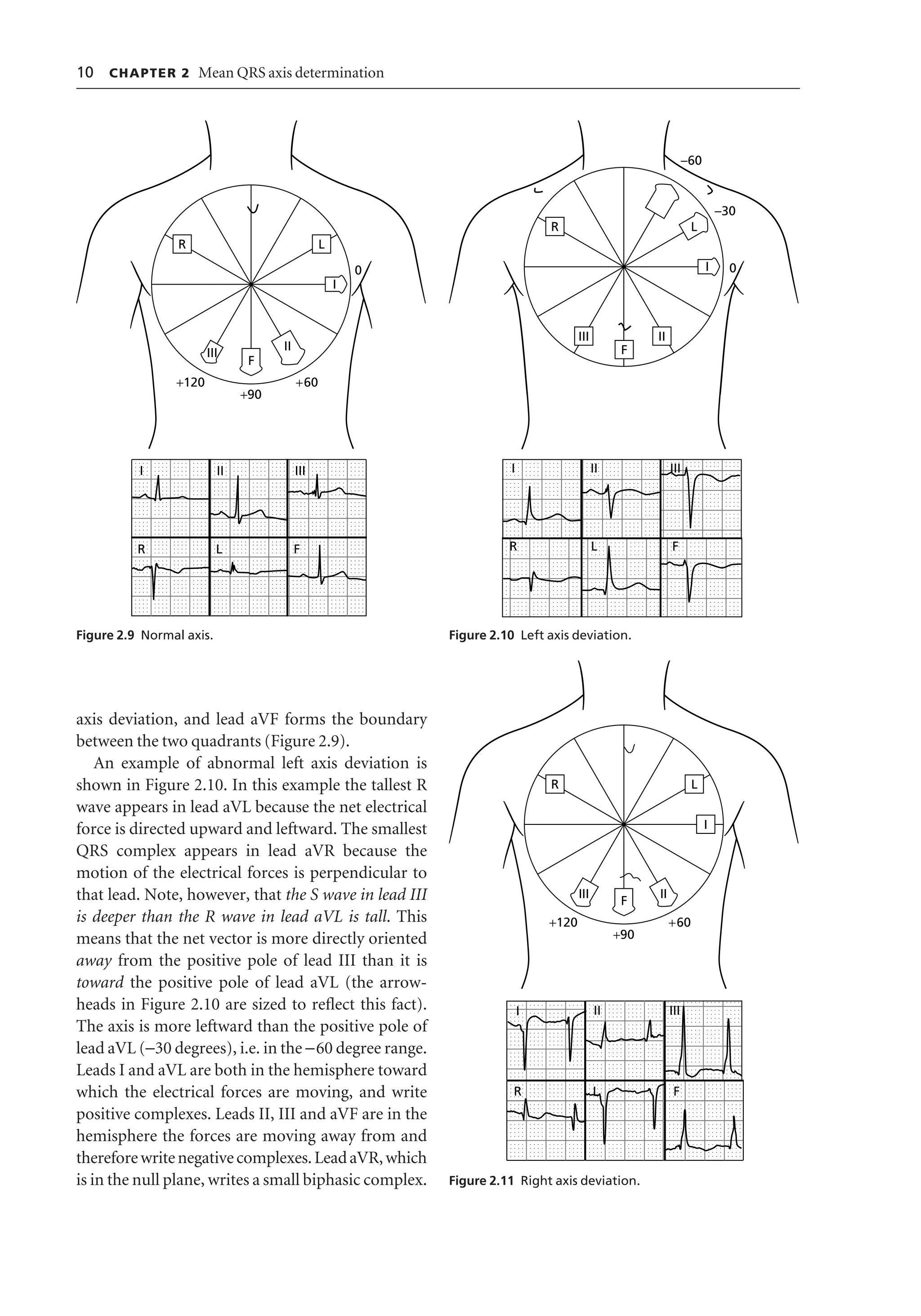 Ecg interpretation | PDF | Heart and Cardiovascular Diseases | Diseases ...