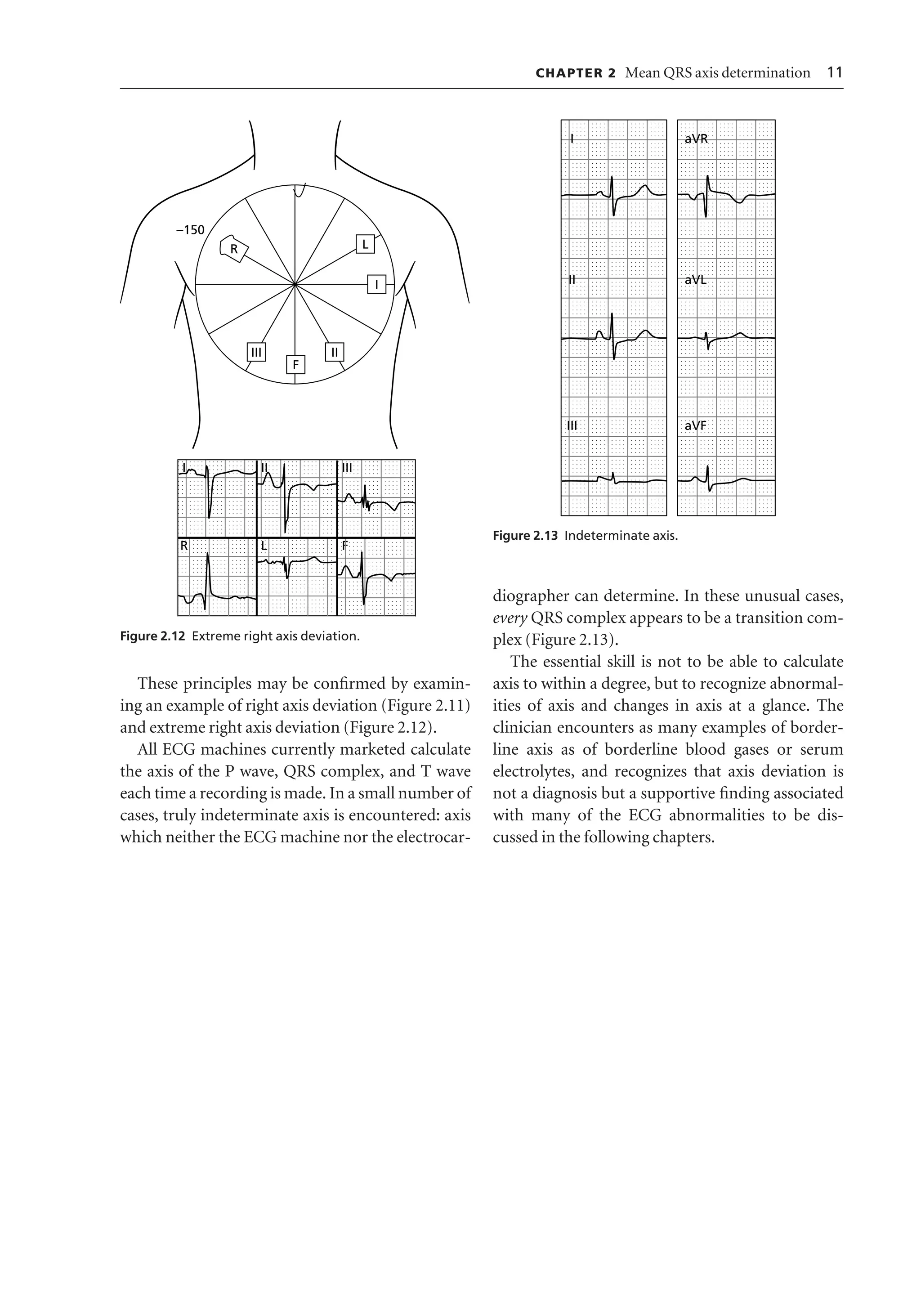 Ecg interpretation | PDF | Heart and Cardiovascular Diseases | Diseases ...