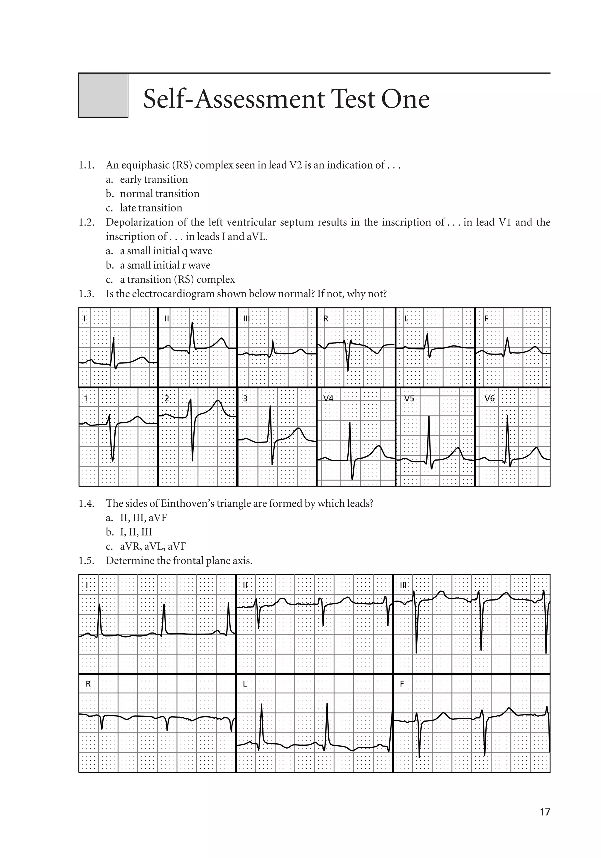 Ecg interpretation | PDF | Heart and Cardiovascular Diseases | Diseases ...
