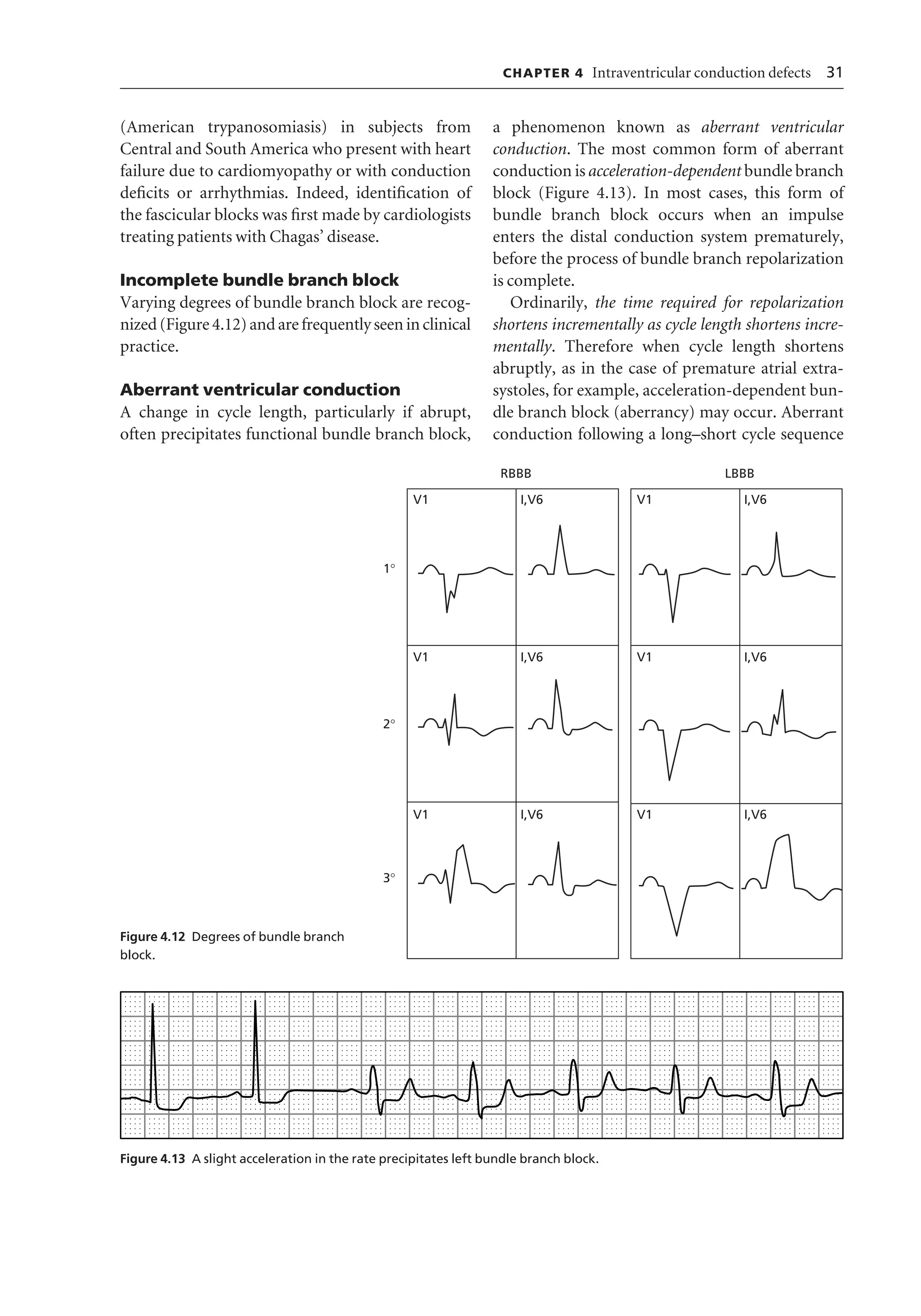 Ecg interpretation | PDF | Heart and Cardiovascular Diseases | Diseases ...