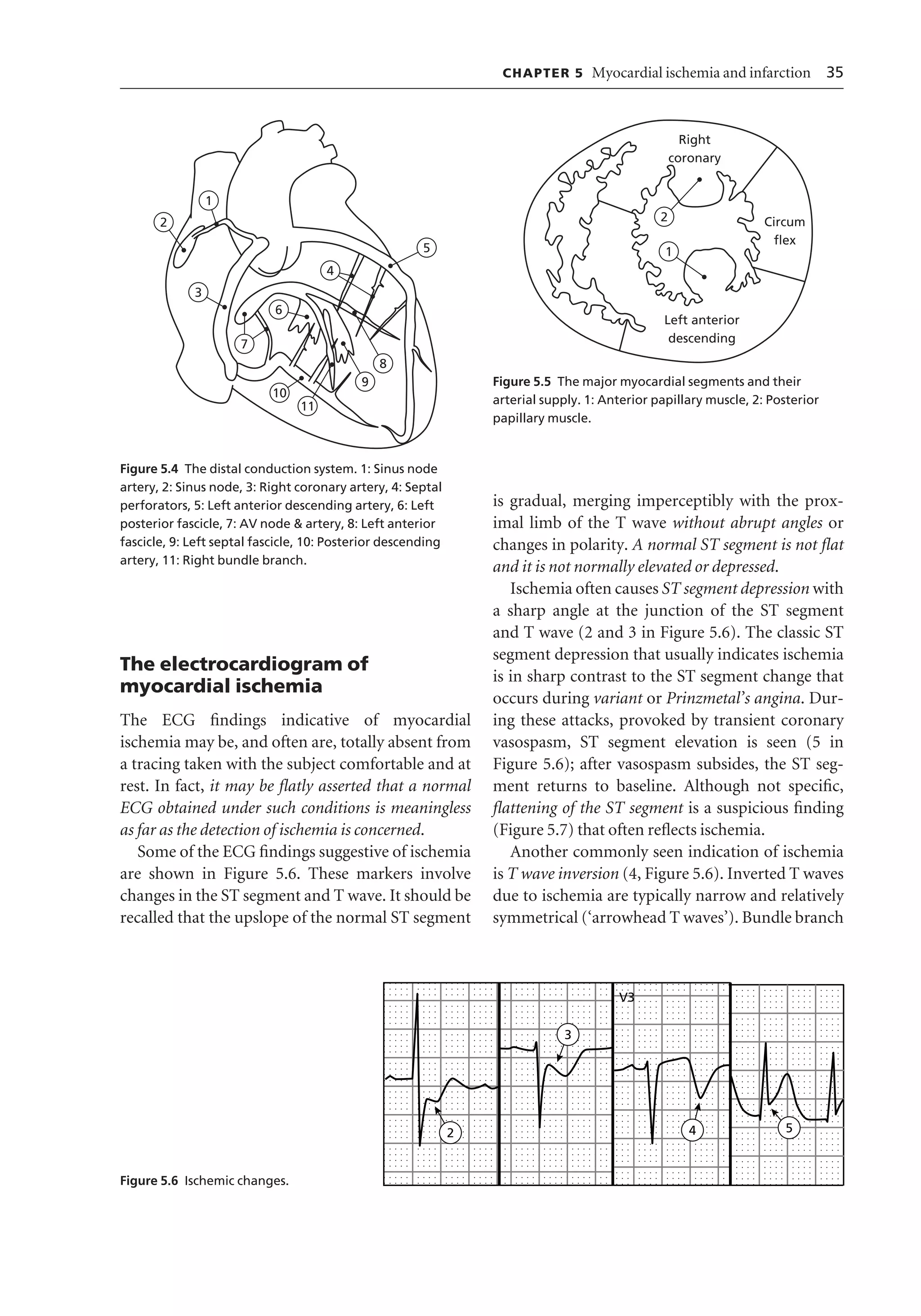Ecg interpretation | PDF | Heart and Cardiovascular Diseases | Diseases ...