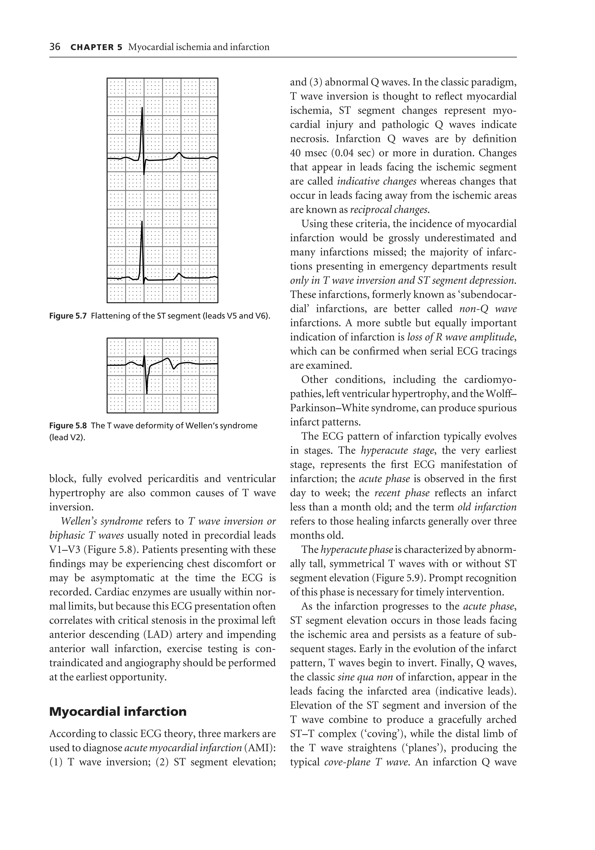 Ecg interpretation | PDF | Heart and Cardiovascular Diseases | Diseases ...
