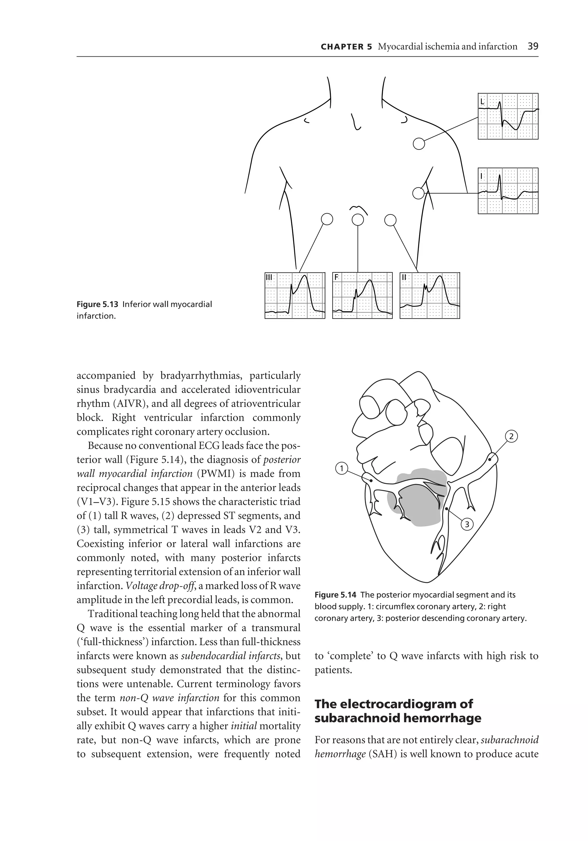 Ecg interpretation | PDF | Heart and Cardiovascular Diseases | Diseases ...