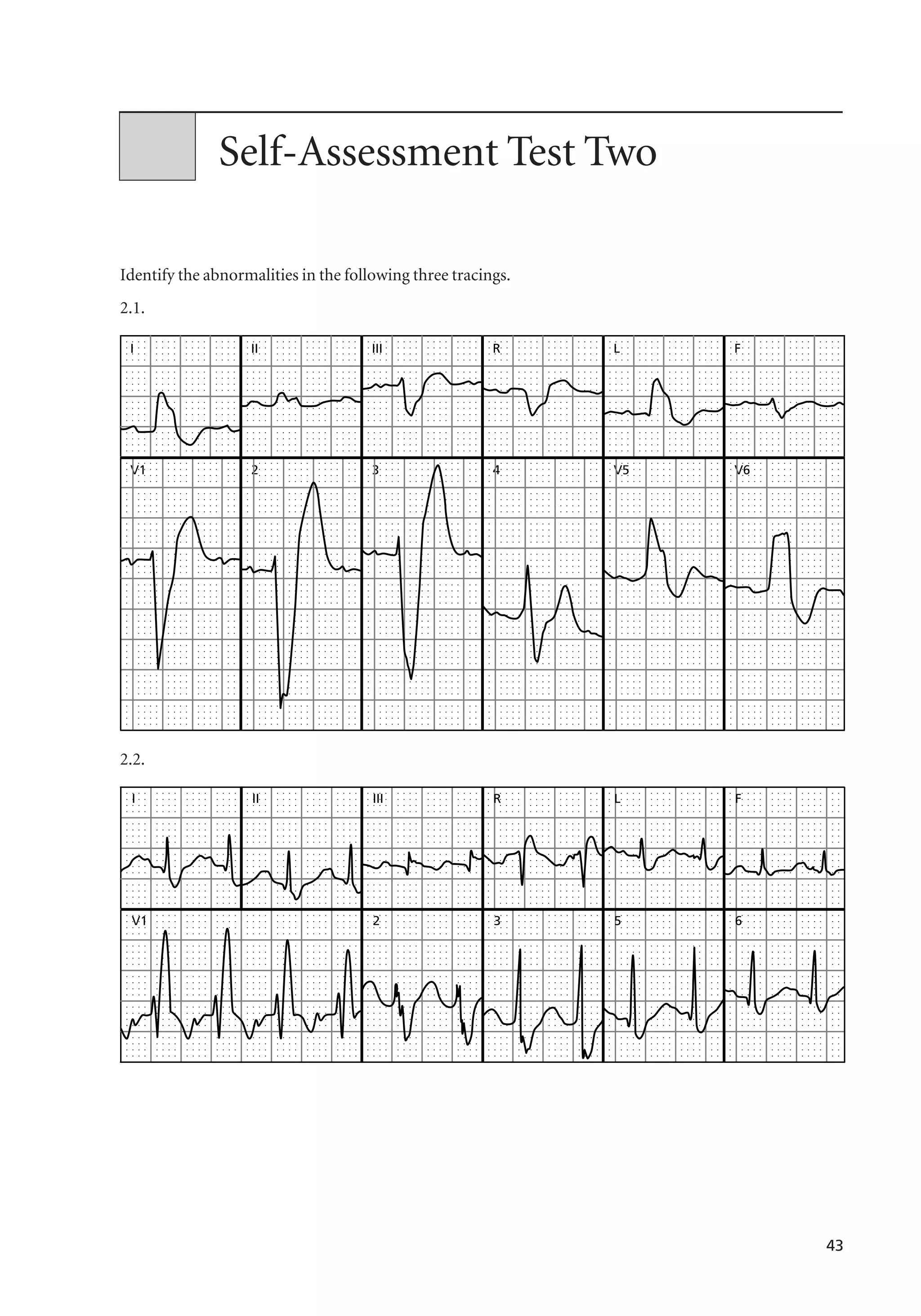 Ecg interpretation | PDF | Heart and Cardiovascular Diseases | Diseases ...