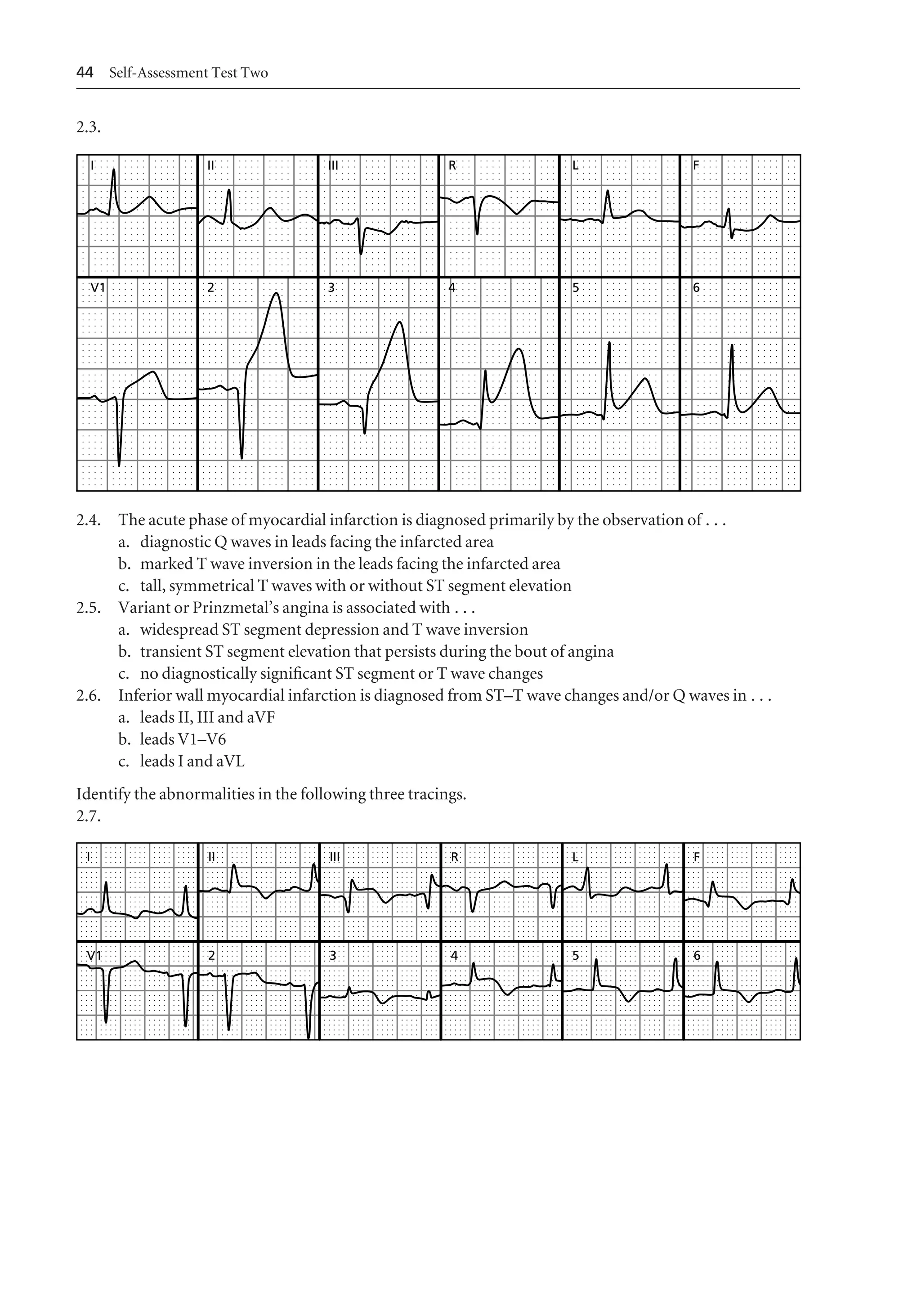 Ecg interpretation | PDF | Heart and Cardiovascular Diseases | Diseases ...
