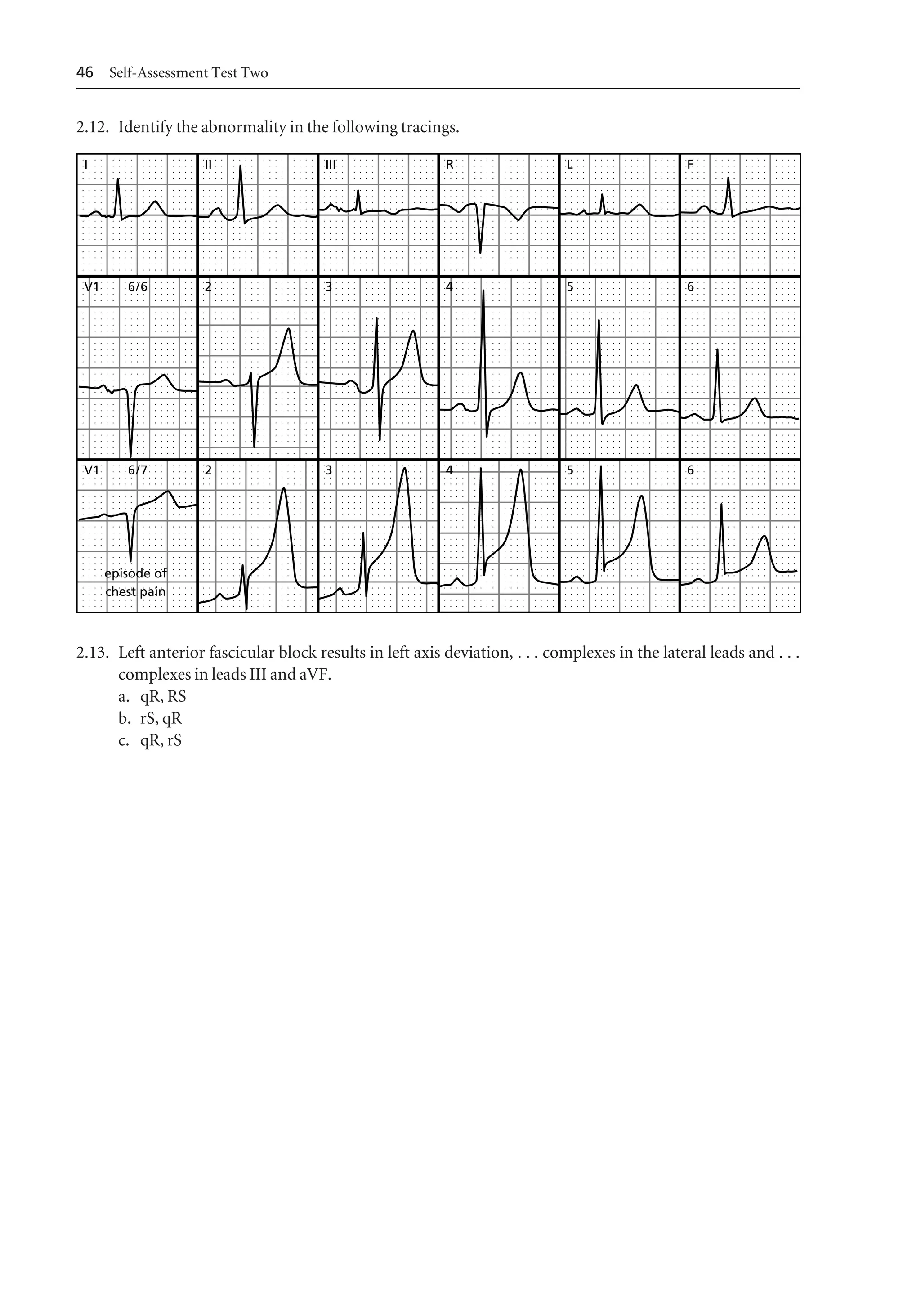 Ecg interpretation | PDF | Heart and Cardiovascular Diseases | Diseases ...