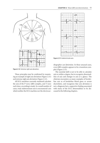 Ecg interpretation | PDF