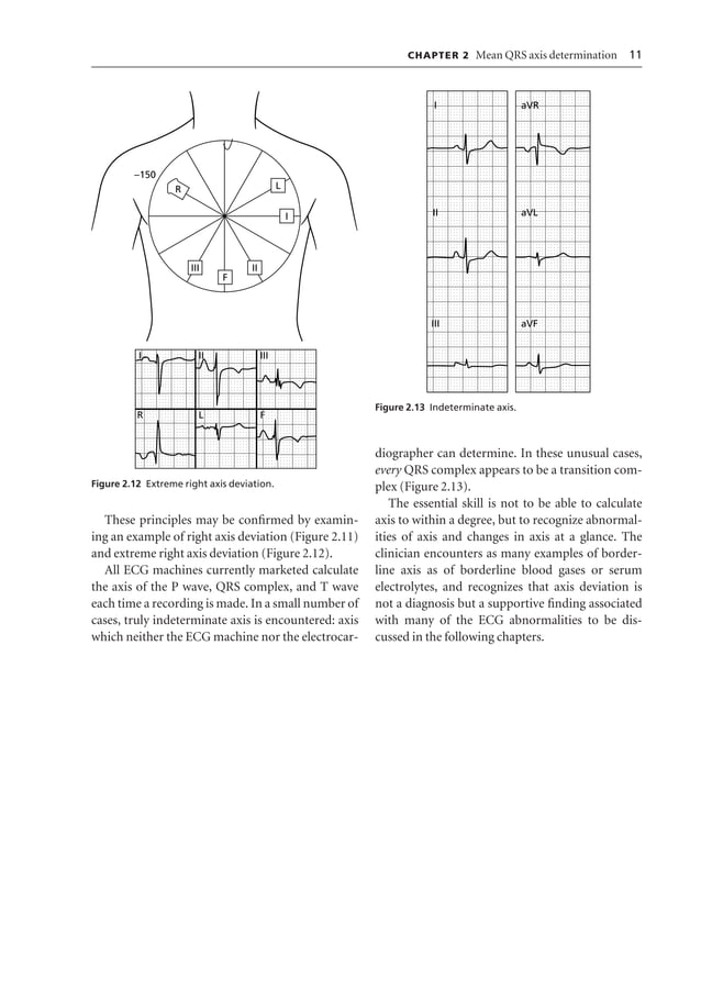 Ecg interpretation | PDF | Heart and Cardiovascular Diseases | Diseases and Conditions