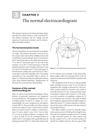 Ecg interpretation | PDF