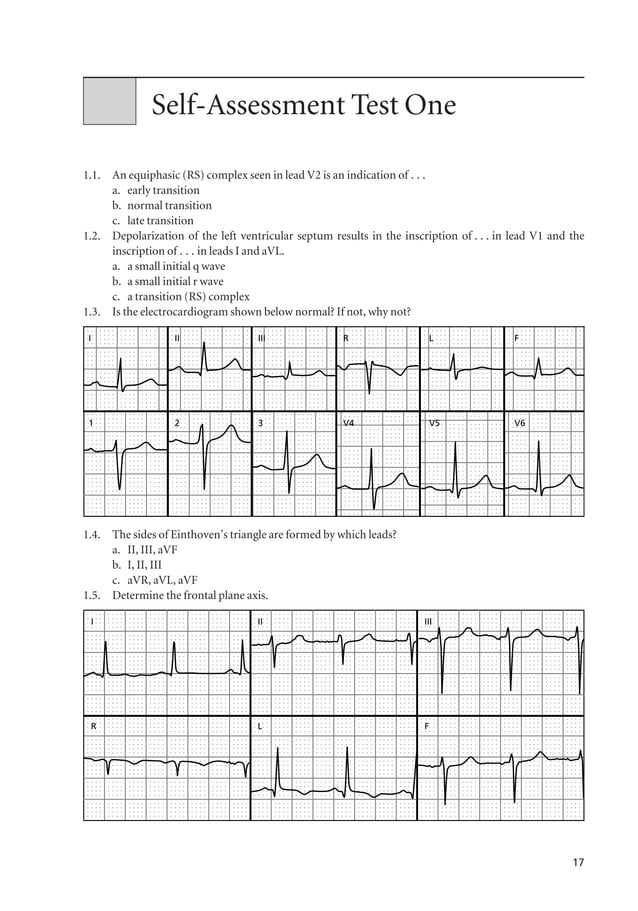 Ecg interpretation | PDF | Heart and Cardiovascular Diseases | Diseases ...