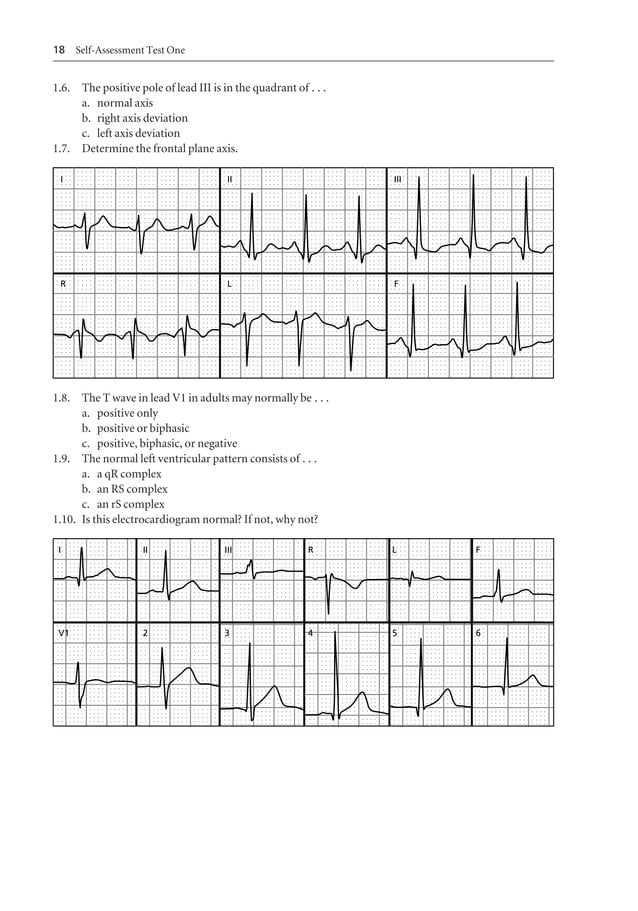 Ecg interpretation | PDF | Heart and Cardiovascular Diseases | Diseases ...