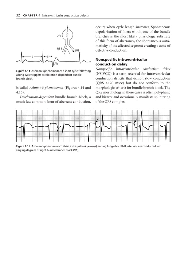 Ecg interpretation | PDF | Heart and Cardiovascular Diseases | Diseases ...