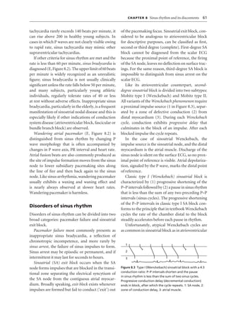 Ecg interpretation | PDF