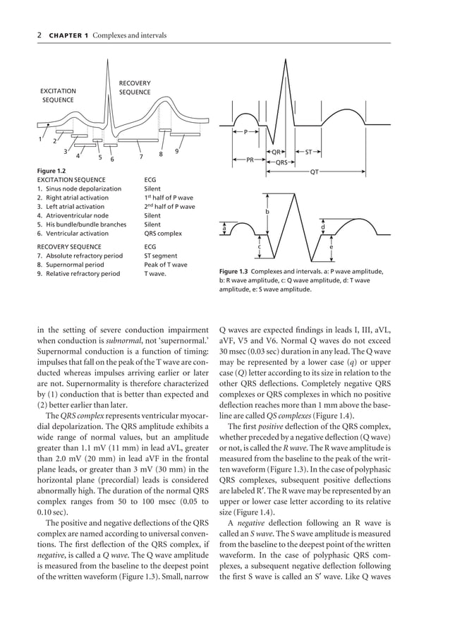 Ecg interpretation | PDF | Heart and Cardiovascular Diseases | Diseases ...