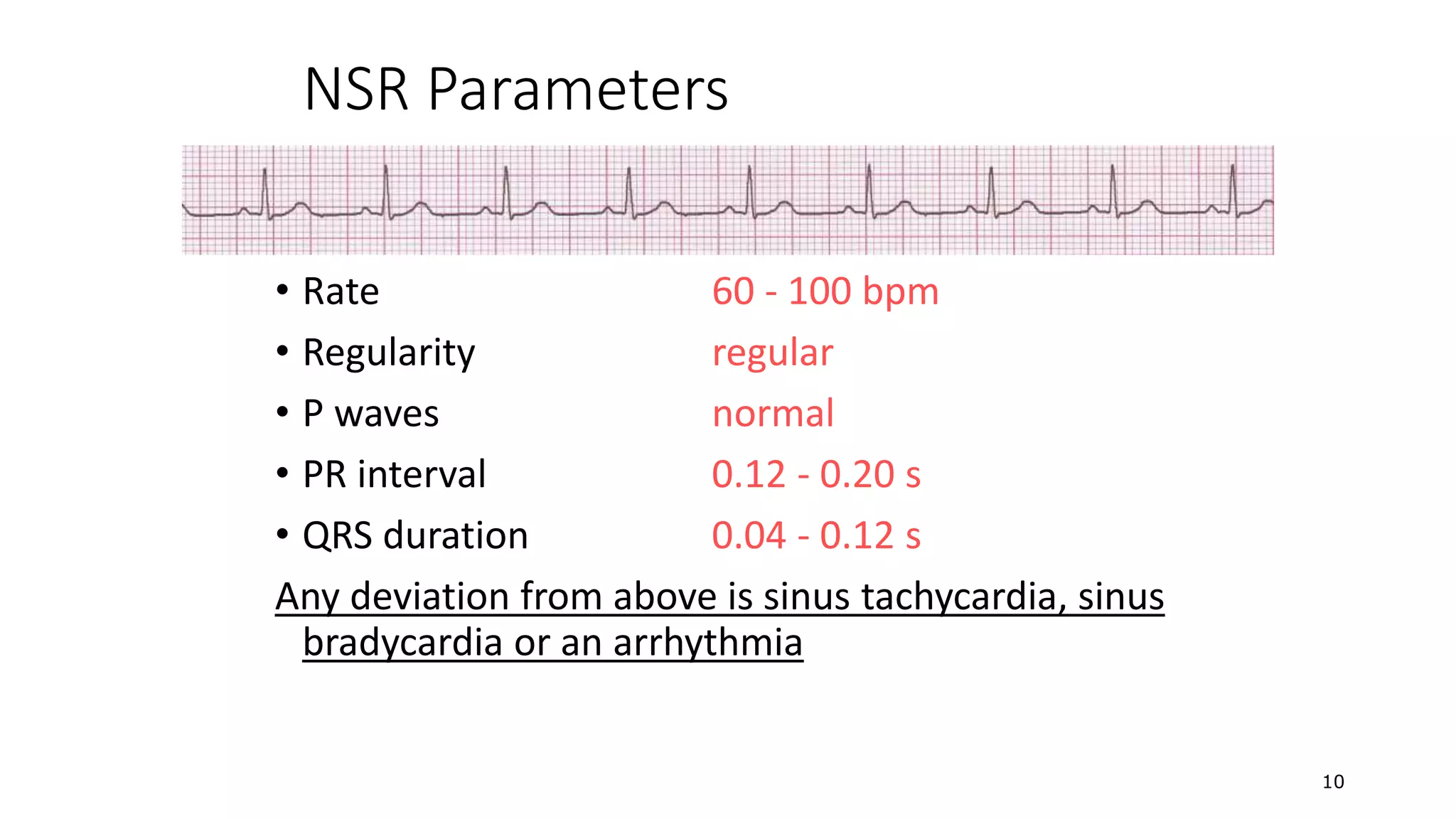 ECG-Interpretation-ppt-for-student.pptx | Heart and Cardiovascular ...