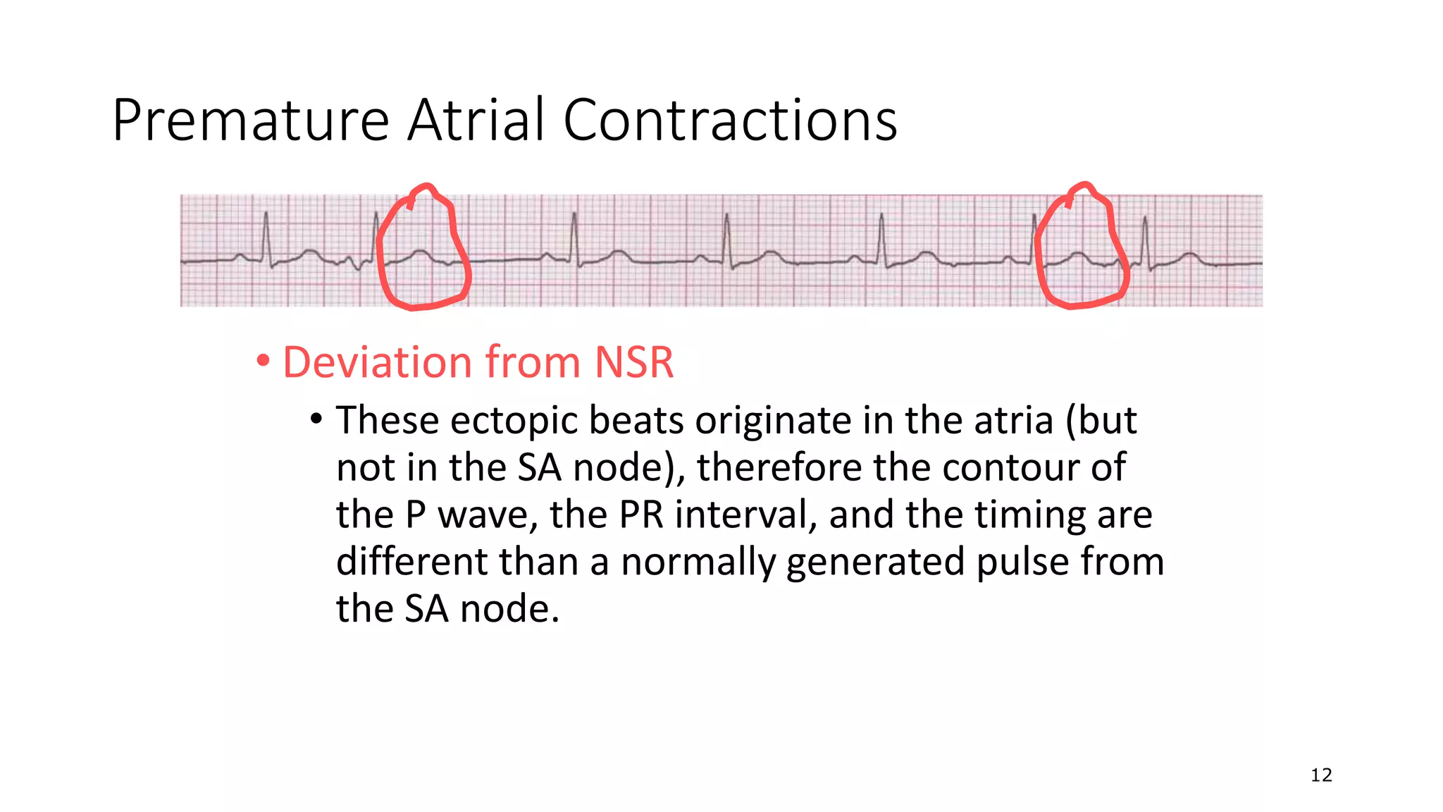 ECG-Interpretation-ppt-for-student.pptx