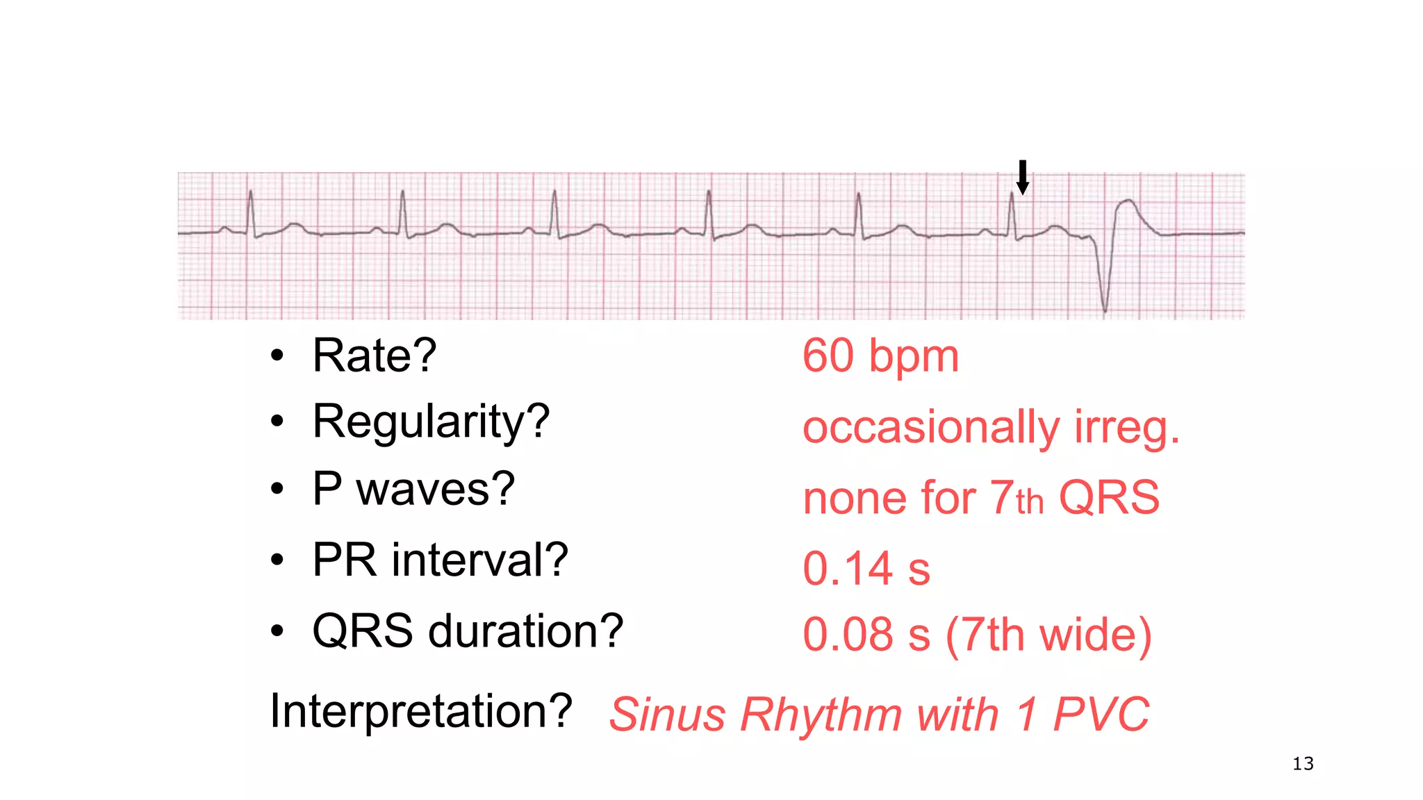 ECG-Interpretation-ppt-for-student.pptx