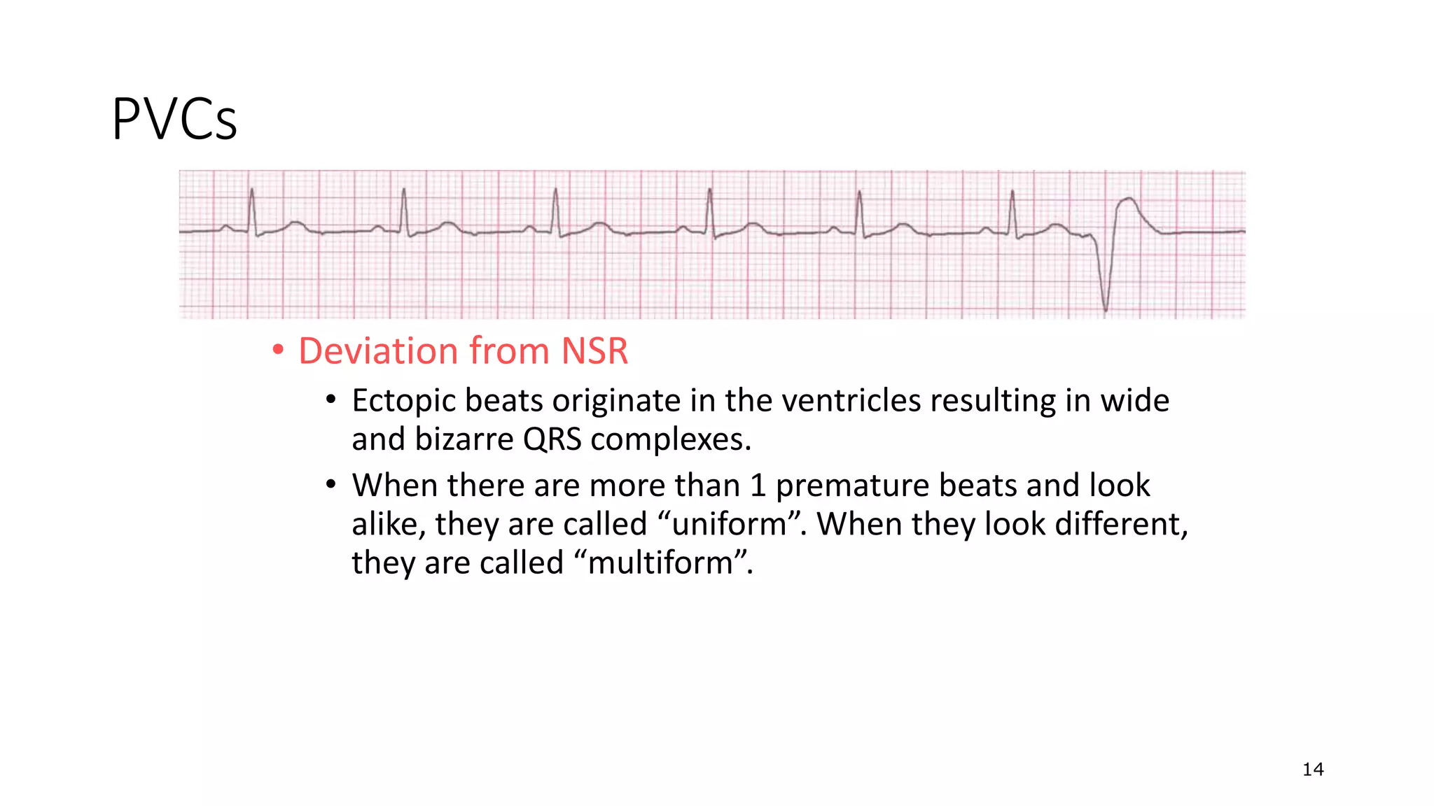 ECG-Interpretation-ppt-for-student.pptx
