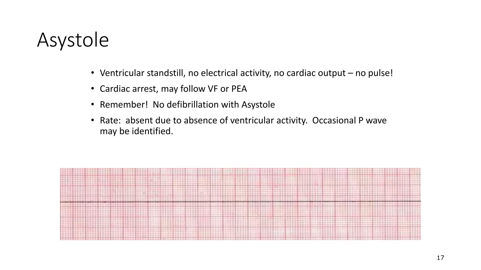 ECG-Interpretation-ppt-for-student.pptx | Heart and Cardiovascular ...